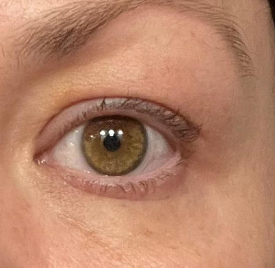 How to Care for the Skin Around the Eye – Skinjuvea